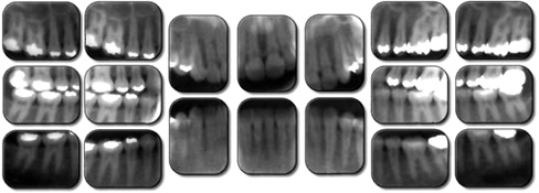 Dental Technology | Dentist, Rogers AR | Steven Kolokithas, DDS